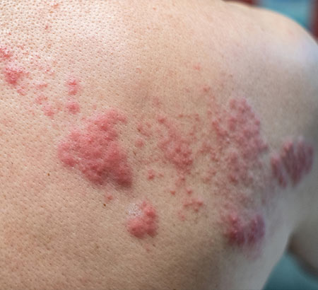 Pharmacy First Service