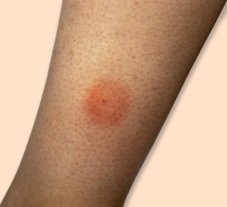 Pharmacy First Service