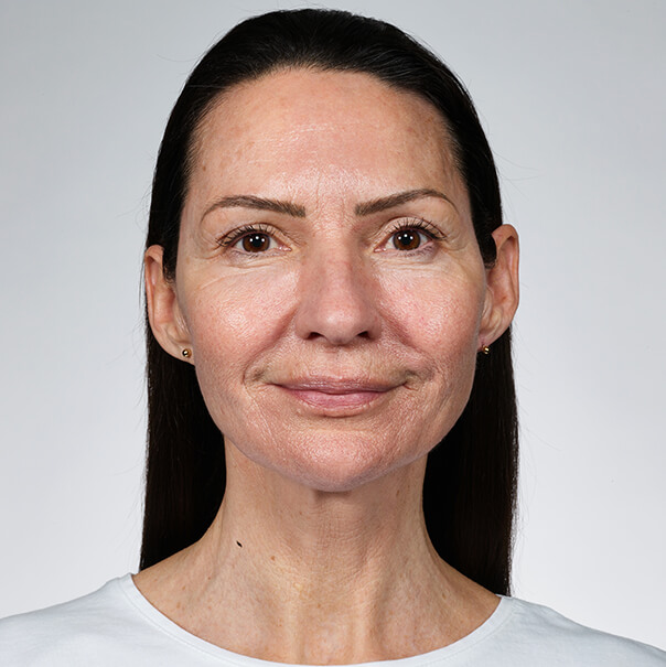 Discover No7 Skin Future Renew