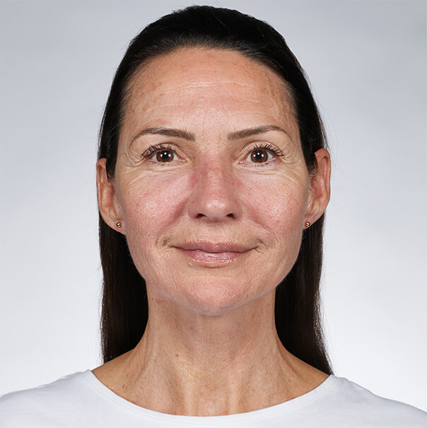 Discover No7 Skin Future Renew